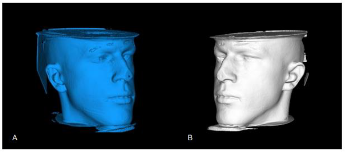Realistic Facial Three-Dimensional Reconstruction from CT Images and 2D ...