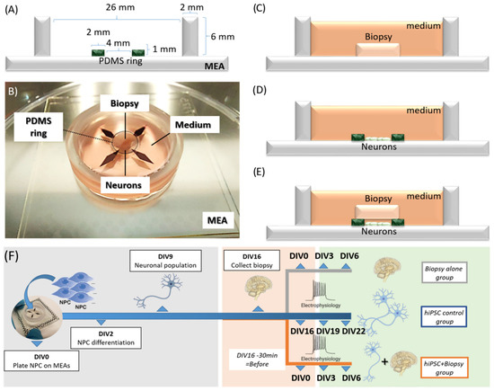 Spontaneous Epileptic Recordings from hiPSC-Derived Cortical Neurons ...