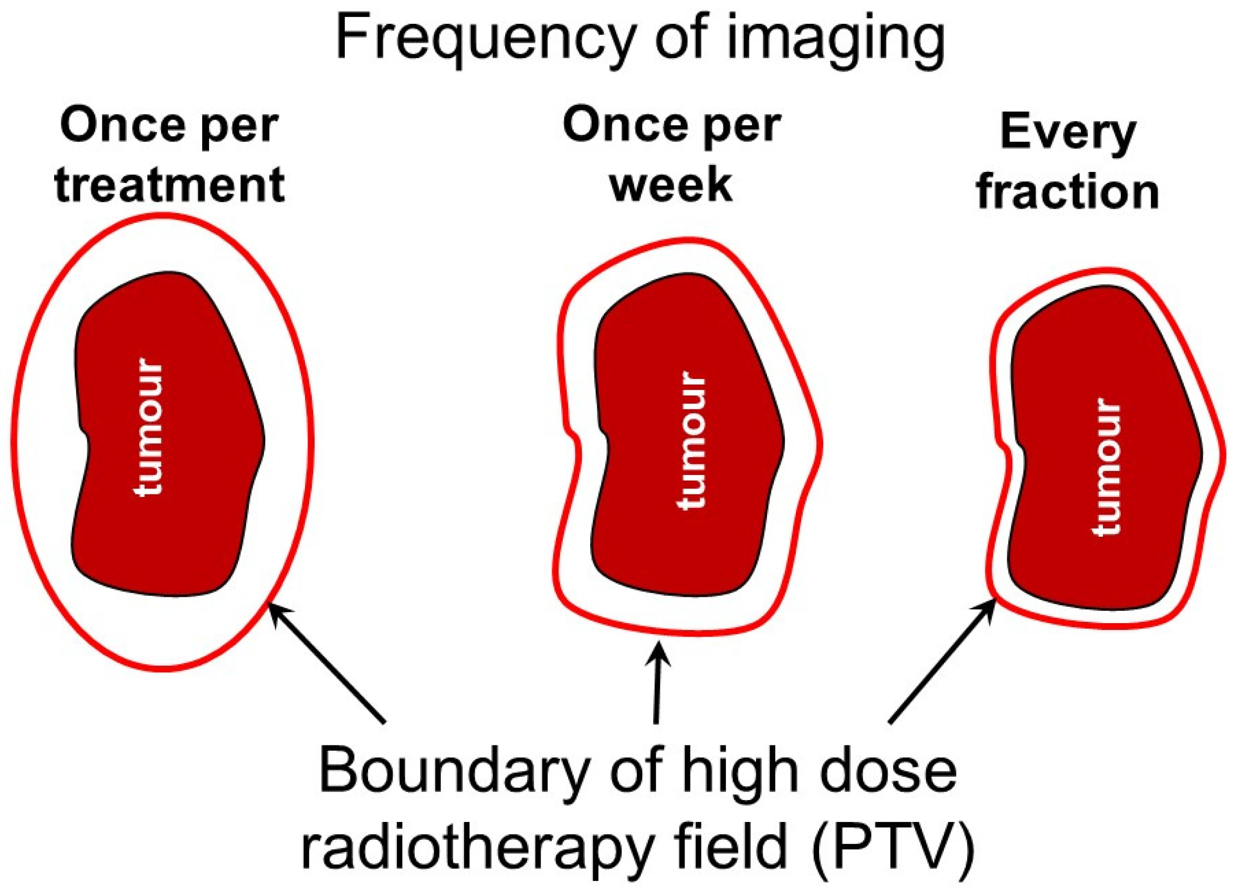 Factors Affecting Implementation of Radiological Protection Aspects of ...