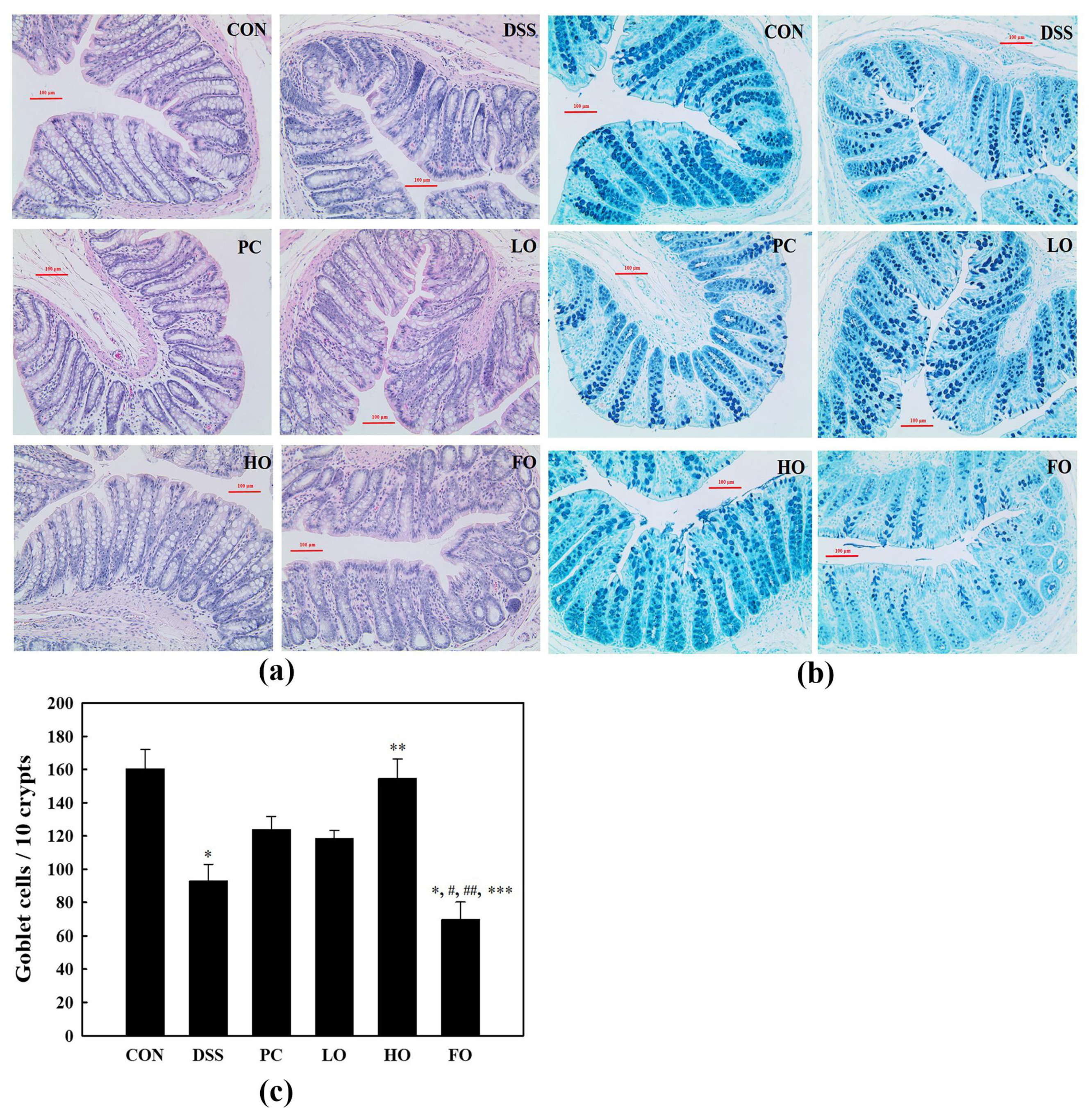Effects of Fermented Onion on Gut Health in Dextran Sodium Sulfate (DSS ...