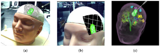 Augmented Reality in Surgical Navigation: A Review of Evaluation and ...