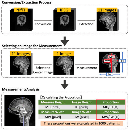 Age Estimation from Brain Magnetic Resonance Images Using Deep Learning ...