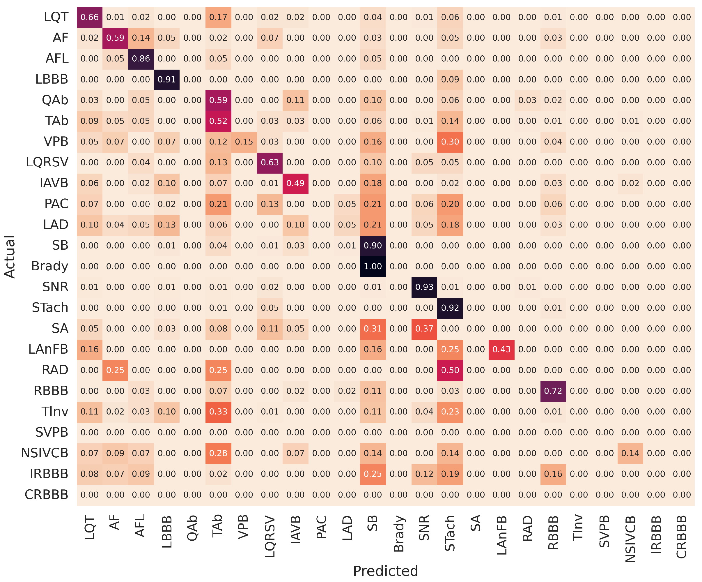 Perturbation-Based Explainable AI for ECG Sensor Data