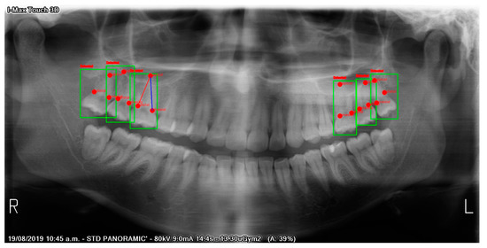 Applied Sciences | Free Full-Text | Automated Assessment of ...