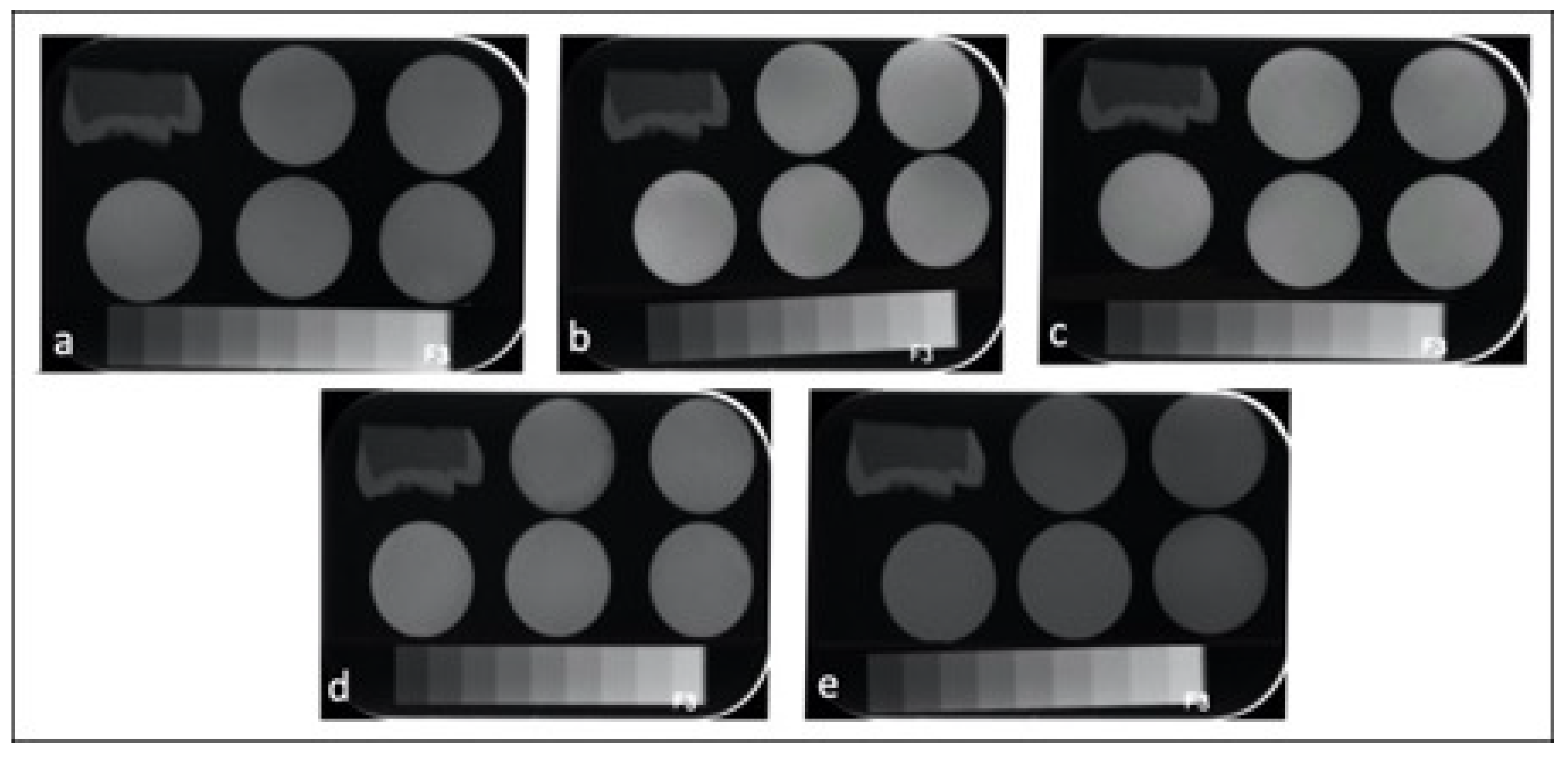 Surface Gloss, Radiopacity and Shear Bond Strength of Contemporary ...