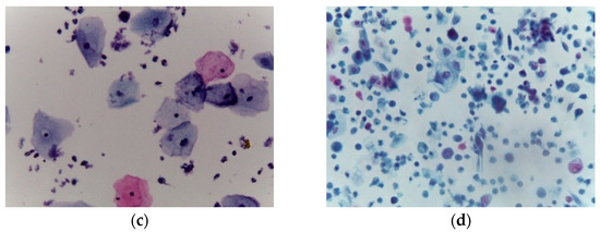 Cervical Cancer Diagnosis Based on Multi-Domain Features Using Deep ...