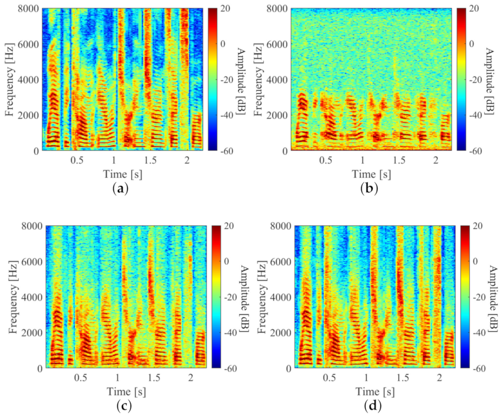 Speech Enhancement Based on Two-Stage Processing with Deep Neural Network for Laser Doppler ...