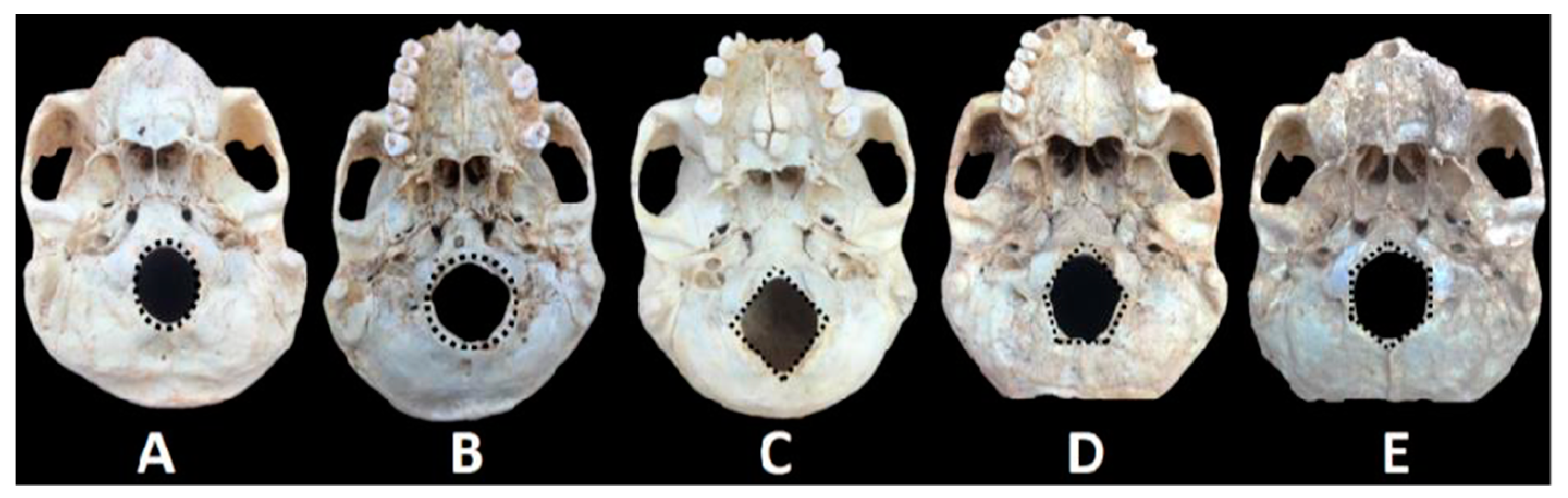 Craniometric Study and Anatomical Variations of Base of Skull in a Thai ...