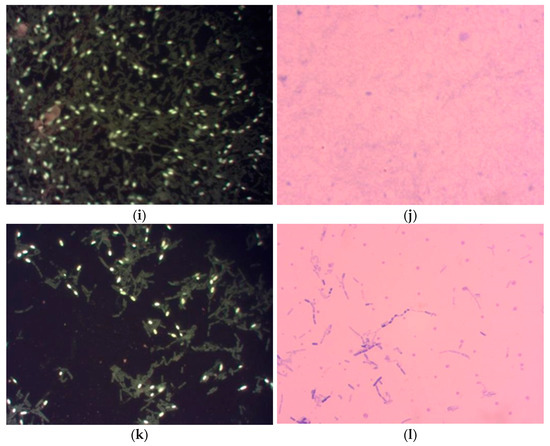 Novel Dose of Natrium Chloride and Soil Concentration in Reducing ...