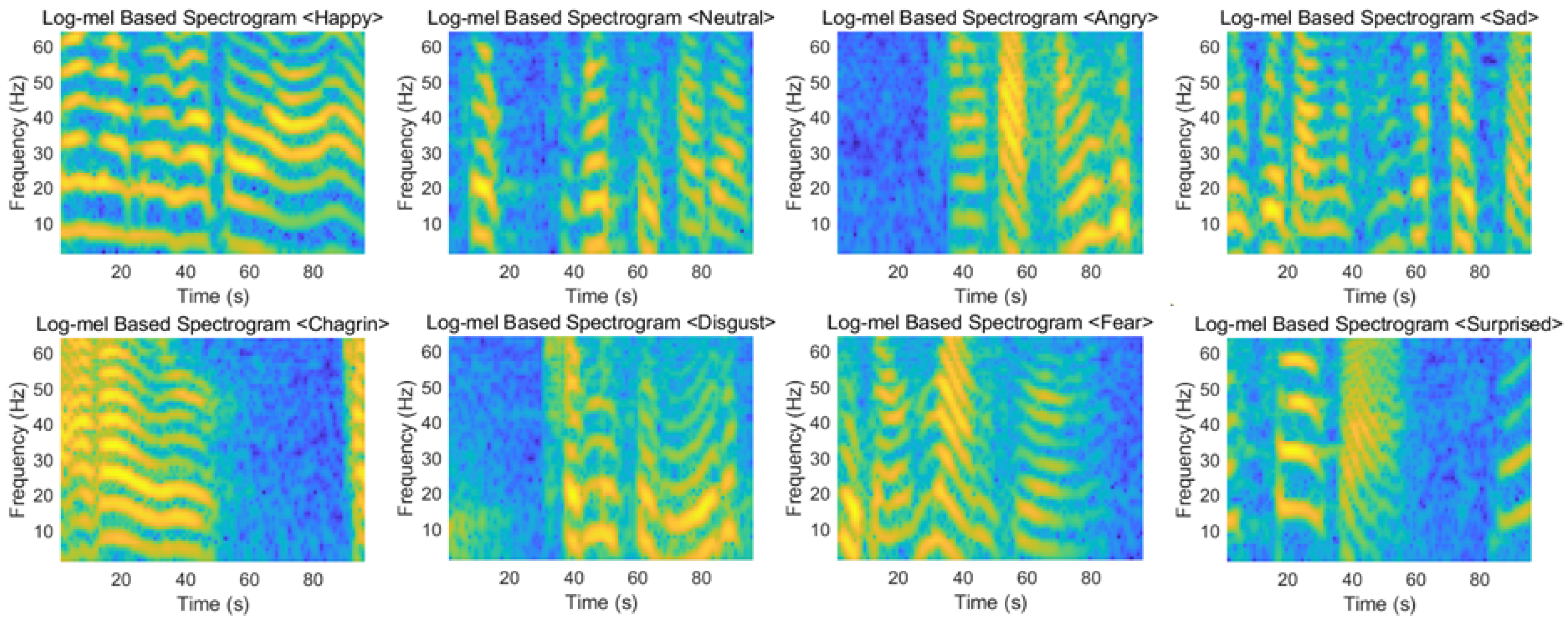 Speech Emotion Recognition Based on Two-Stream Deep Learning Model ...