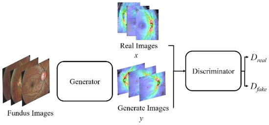 A Glaucoma Detection System Based on Generative Adversarial Network and ...