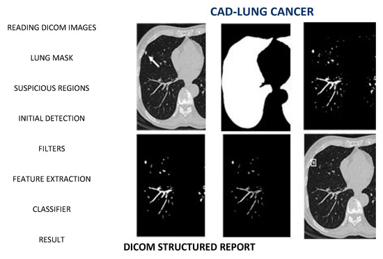 Applied Sciences | Free Full-Text | Digital Medical X-ray Imaging, CAD in Lung Cancer and ...