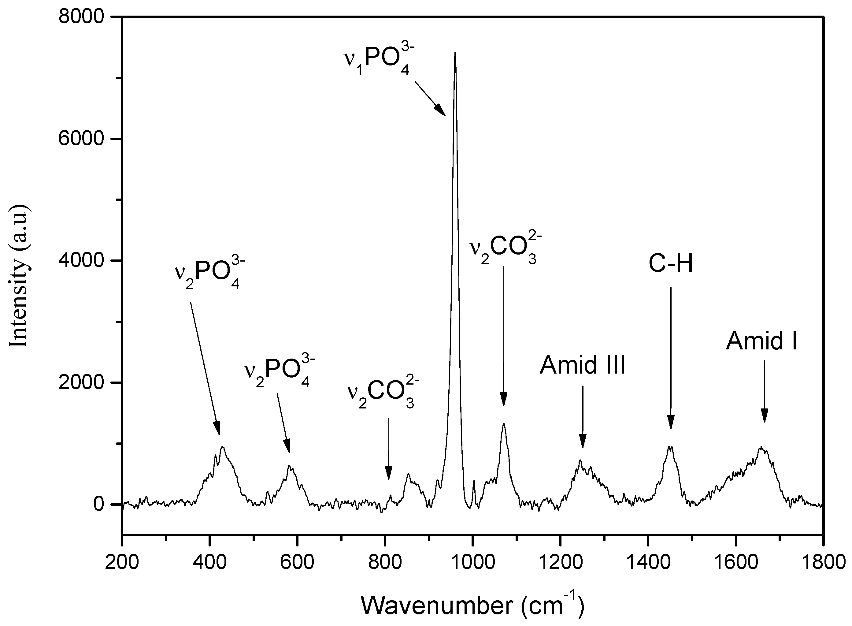 Analysis of Bone Microstructural Changes Using Raman Spectroscopy in ...
