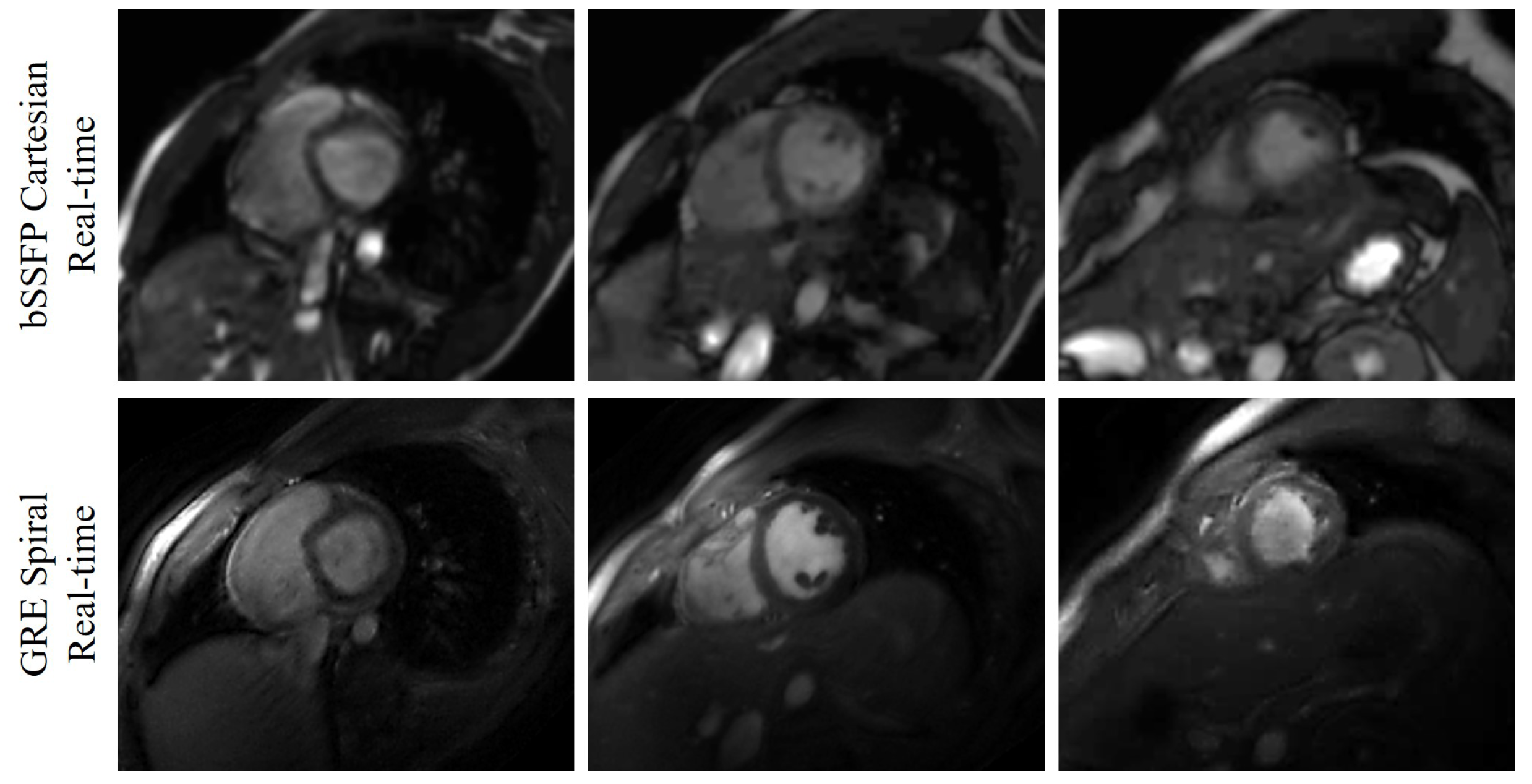 Free-Breathing and Ungated Cardiac MRI Reconstruction Using a Deep Kernel Representation