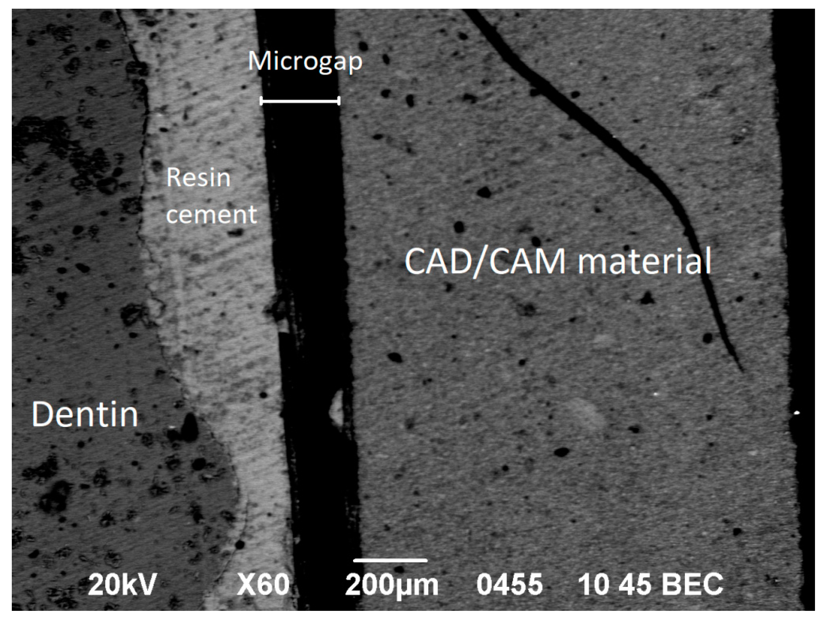 Microgap Formation between a Dental Resin-Matrix Computer-Aided Design ...