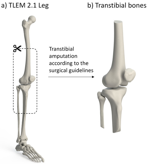Applied Sciences | Free Full-Text | Development of a Generic Numerical Transtibial Model for ...