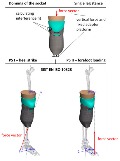 Development of a Generic Numerical Transtibial Model for Limb ...