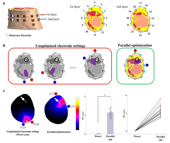 Optimization Framework for Temporal Interference Current Tibial Nerve ...