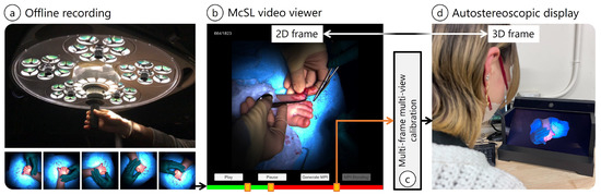 Multi-View Surgical Camera Calibration with None-Feature-Rich Video ...