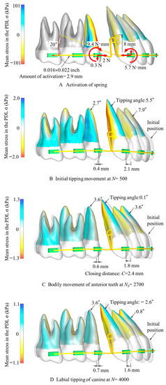 Biomechanical Analysis of Extraction Space Closure with Various Loop ...