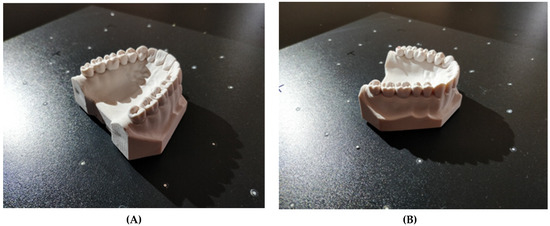 Accuracy of Three-Dimensional Printed Dental Models Based on Ethylene ...