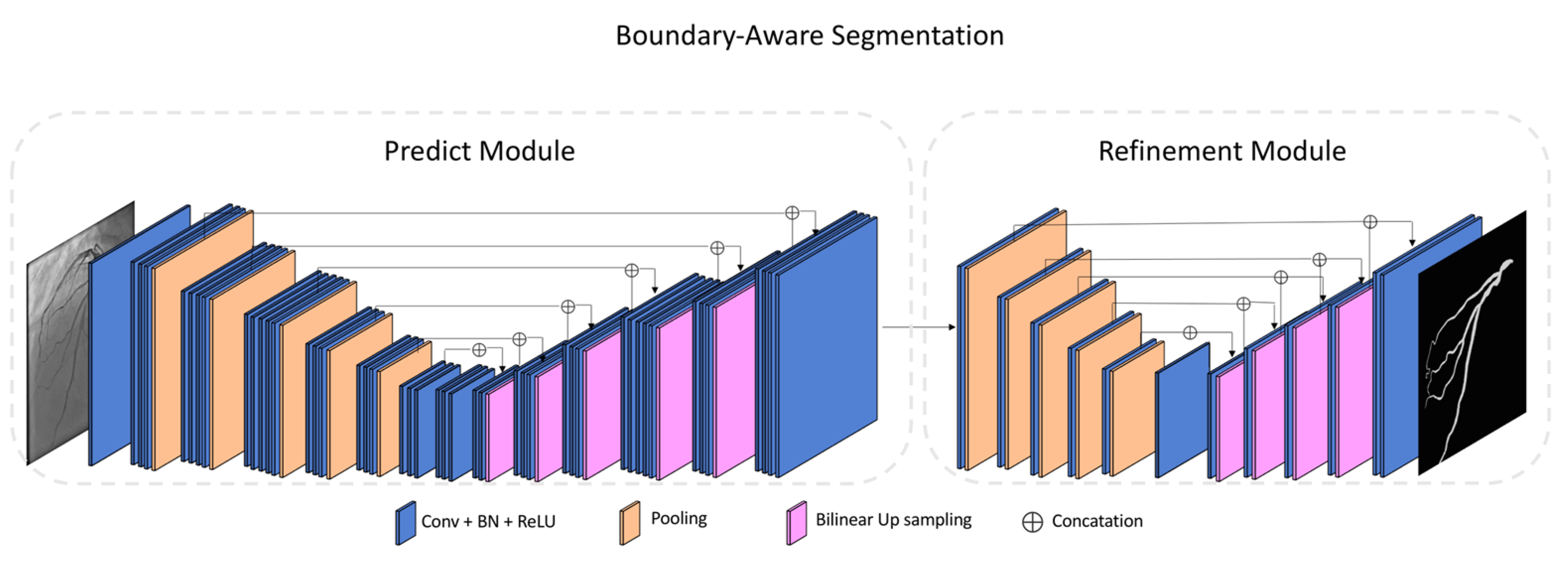 Automatic Quantitative Coronary Analysis Based on Deep Learning
