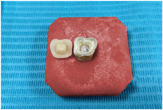 Fracture Resistance Evaluation and Failure Modes Rating Agreement for ...