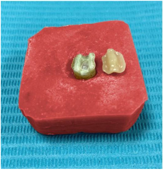 Fracture Resistance Evaluation and Failure Modes Rating Agreement for ...