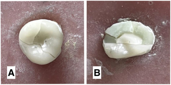 Fracture Resistance Evaluation and Failure Modes Rating Agreement for ...