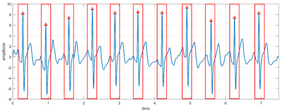 Deep Contrastive Learning-Based Model for ECG Biometrics