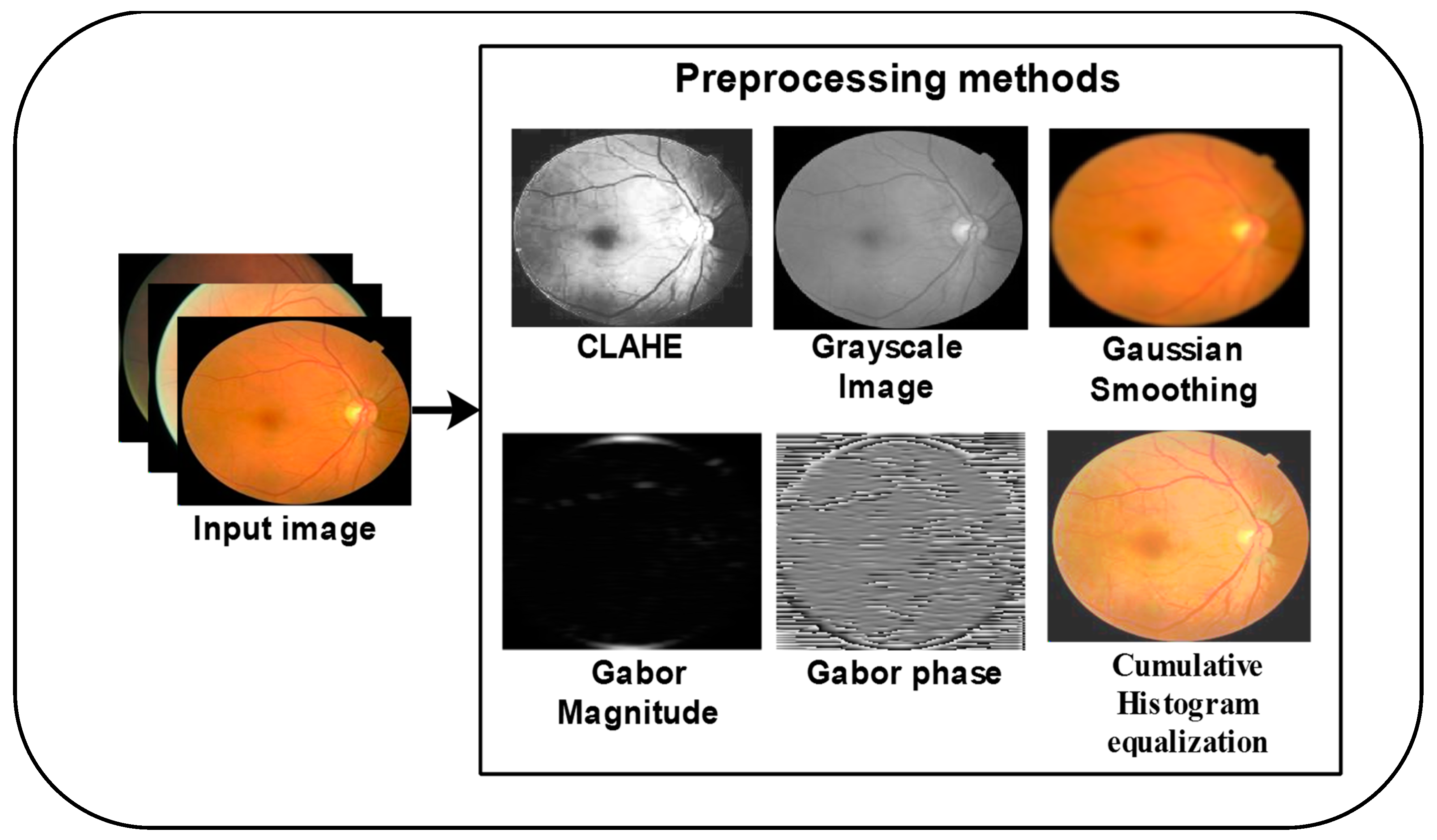 Classification and Segmentation of Diabetic Retinopathy: A Systemic Review