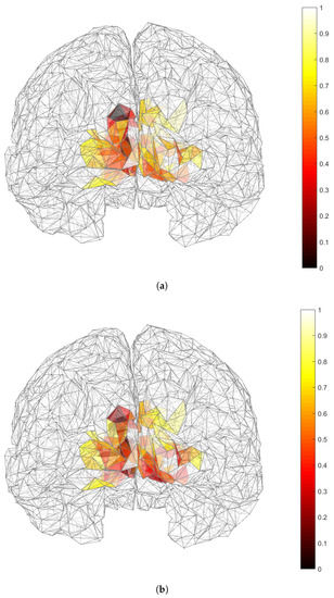 Interference Suppression in EEG Dipole Source Localization through ...