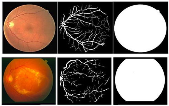 A Convolutional Autoencoder Approach for Boosting the Specificity of ...