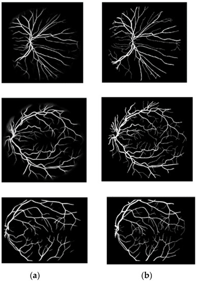 A Convolutional Autoencoder Approach for Boosting the Specificity of ...