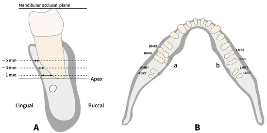 Applied Sciences | Free Full-Text | A CBCT Evaluation of the Proximity ...