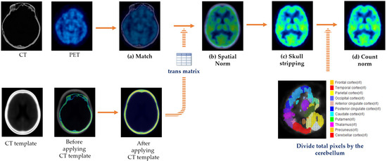 Vision Transformer Approach for Classification of Alzheimer’s Disease ...