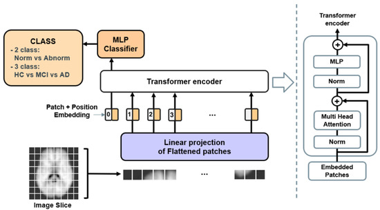 Vision Transformer Approach for Classification of Alzheimer’s Disease Using 18F-Florbetaben ...