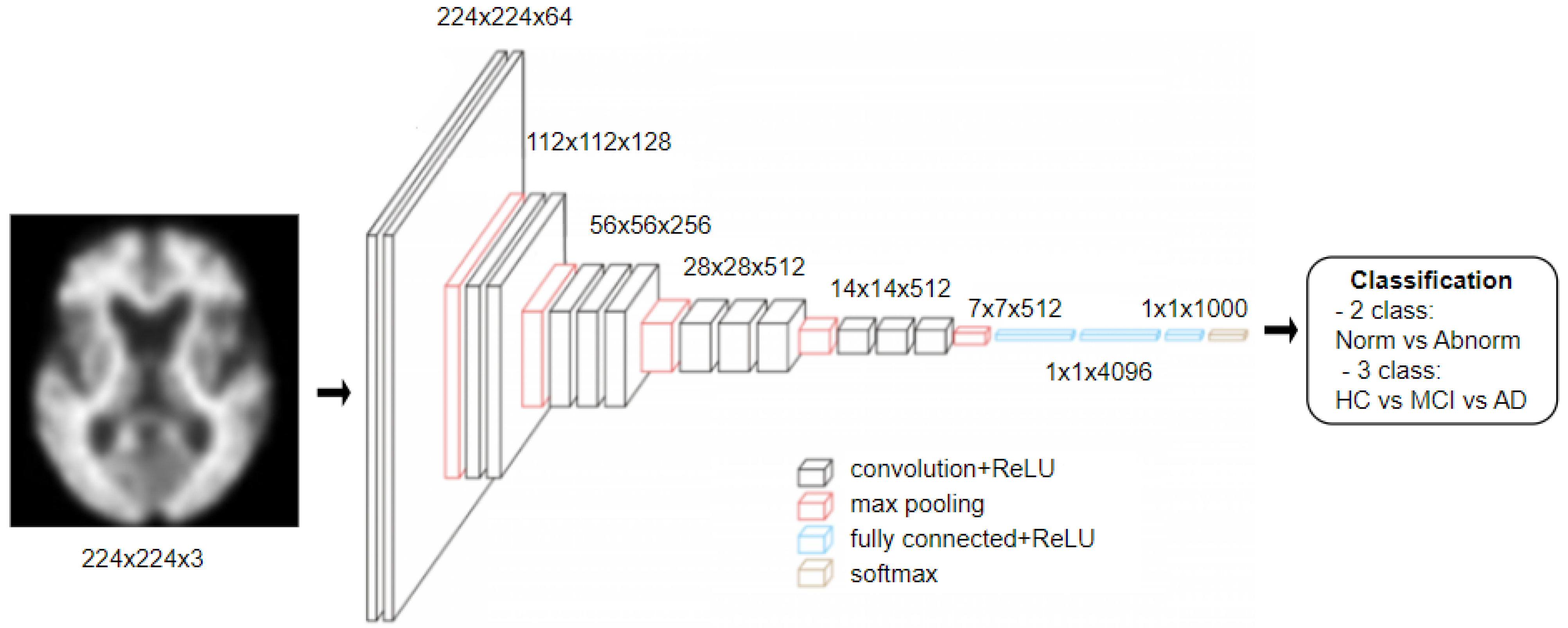Vision Transformer Approach for Classification of Alzheimer’s Disease ...