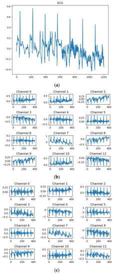 A Domain-Based, Adaptive, Multi-Scale, Inter-Subject Sleep Stage Classification Network