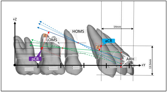 Finite Element Analysis of Maxillary Teeth Movement with Time during En ...