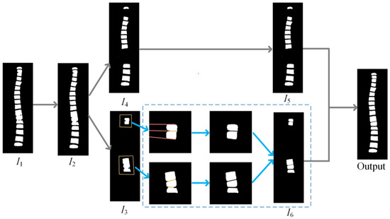 Applied Sciences | Free Full-Text | Lenke Classification of Scoliosis ...