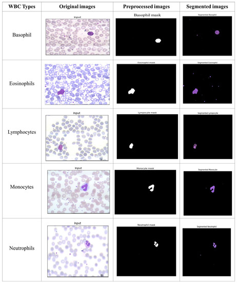 Ghost-ResNeXt: An Effective Deep Learning Based on Mature and Immature WBC Classification