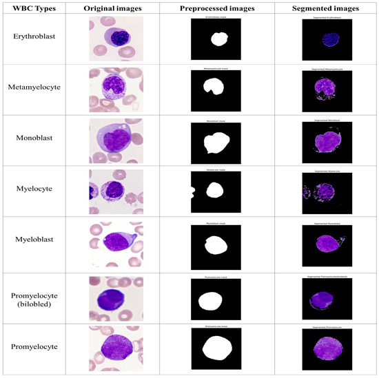 Ghost-ResNeXt: An Effective Deep Learning Based on Mature and Immature WBC Classification