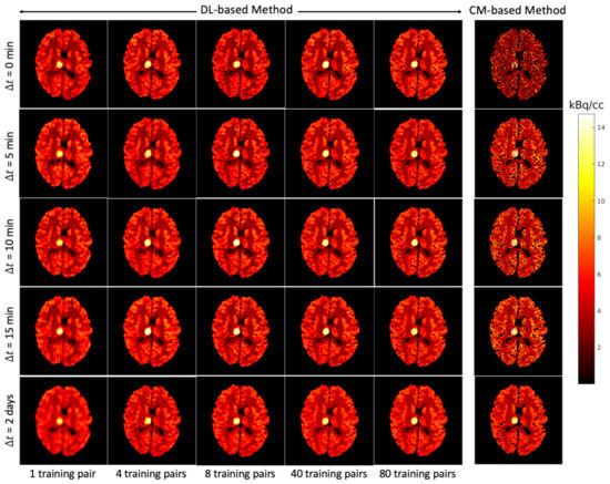 Dual-Tracer PET Image Separation by Deep Learning: A Simulation Study