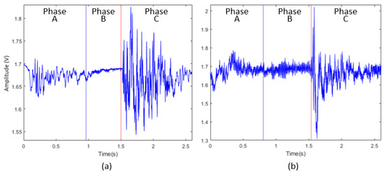 Determining Obstruction in Endotracheal Tubes Using Physical ...