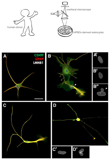 Predicting Astrocytic Nuclear Morphology with Machine Learning: A Tree Ensemble Classifier Study