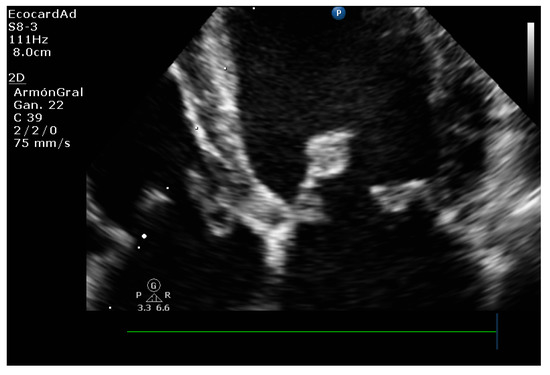 Translational Echocardiography: The Dog as a Clinical Research Model of ...