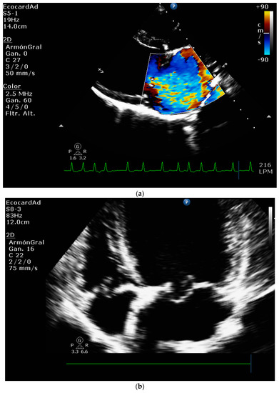 Translational Echocardiography: The Dog as a Clinical Research Model of ...