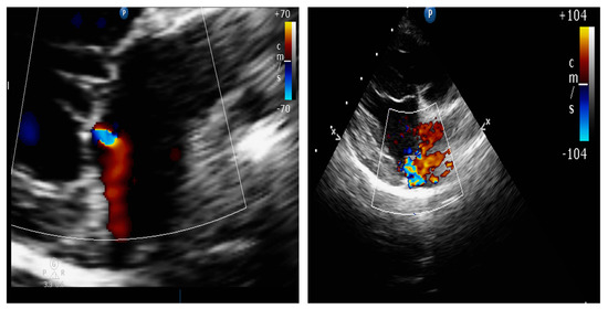 Translational Echocardiography: The Dog as a Clinical Research Model of ...