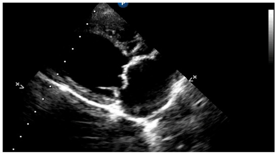 Translational Echocardiography: The Dog as a Clinical Research Model of ...